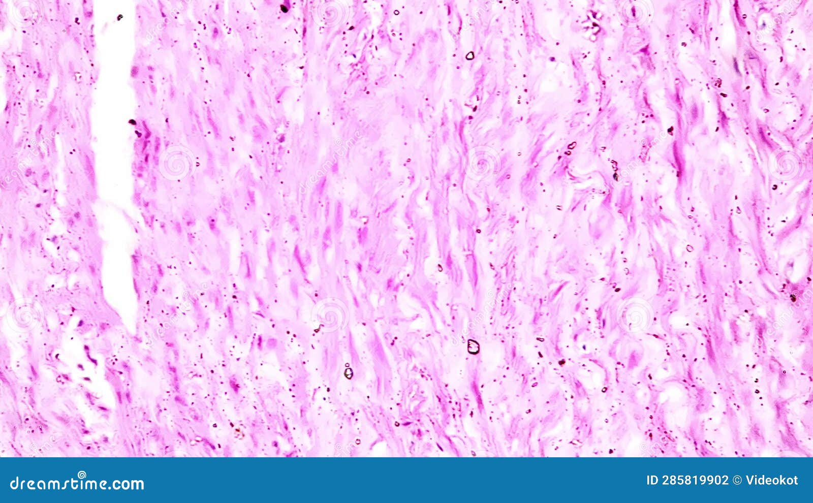 Human Large Artery Examined in an Experiment and Observed Under a ...