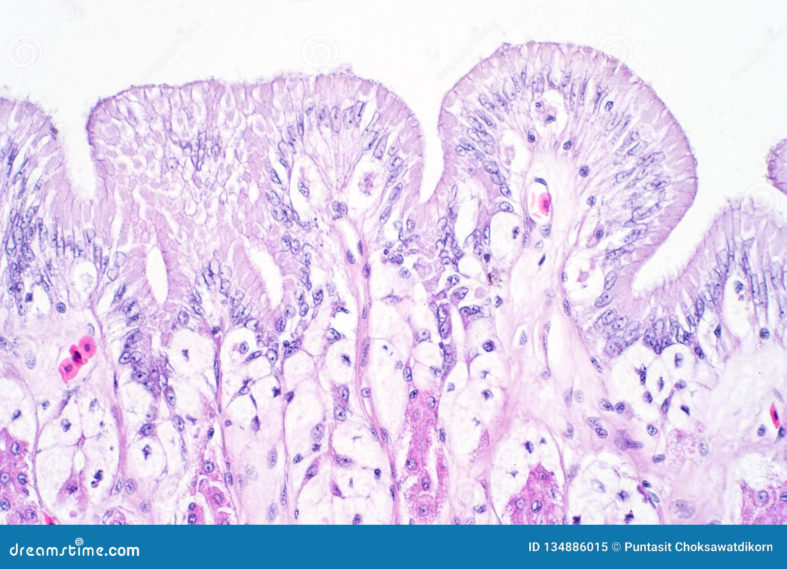 Human Large Intestine Tissue Under Microscope View Stock Image - Image ...