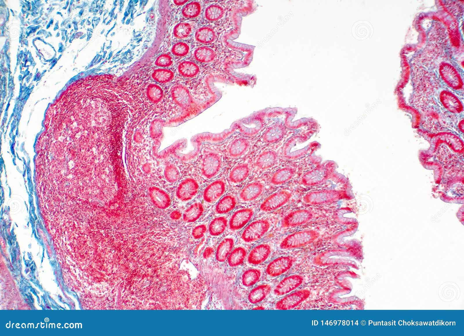 Human Large Intestine Tissue Under Microscope View Stock Illustration ...