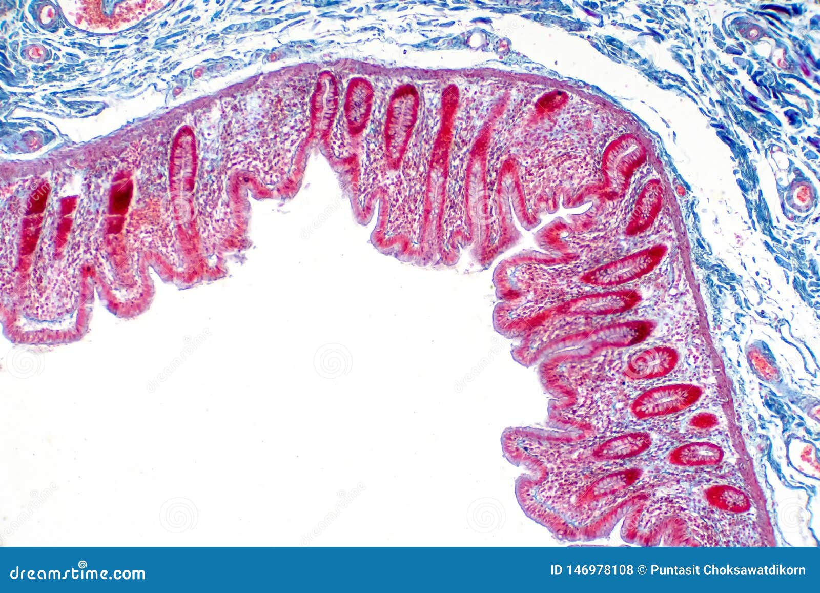 Human Large Intestine Tissue Under Microscope View Stock Illustration ...