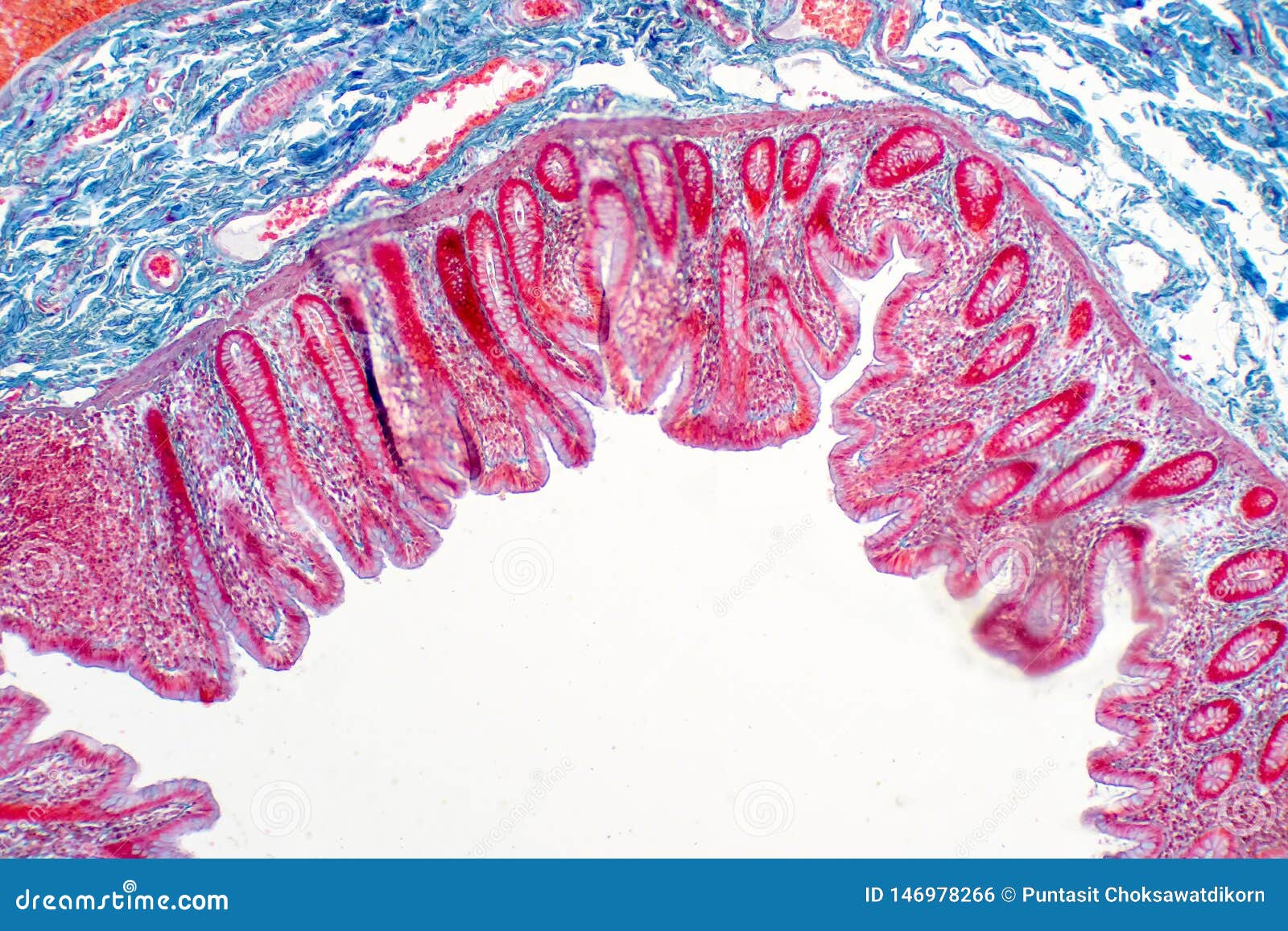 Large Intestine Histology Labeled
