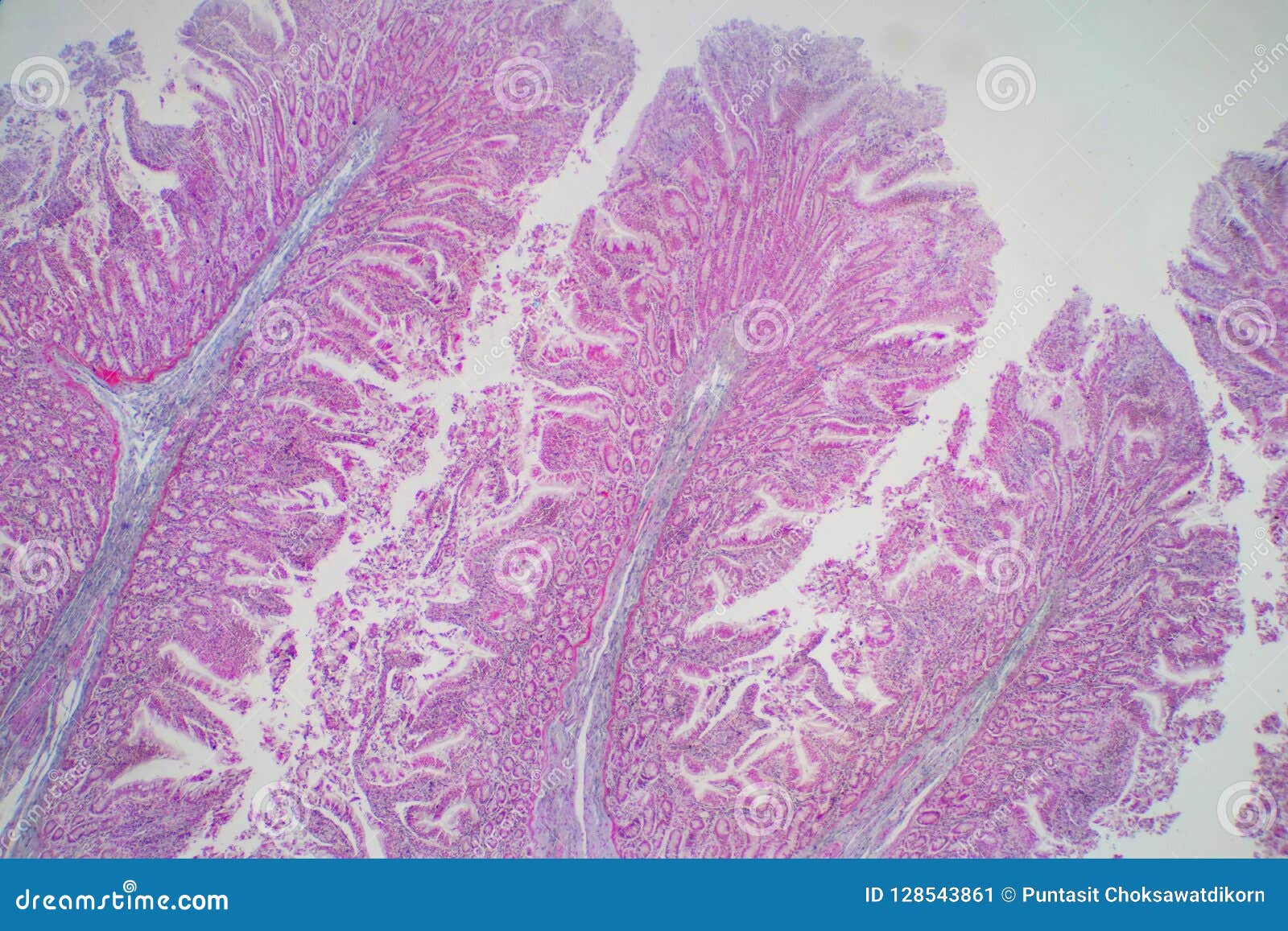 Human Large Intestine Tissue Under Microscope View Stock Image - Image ...