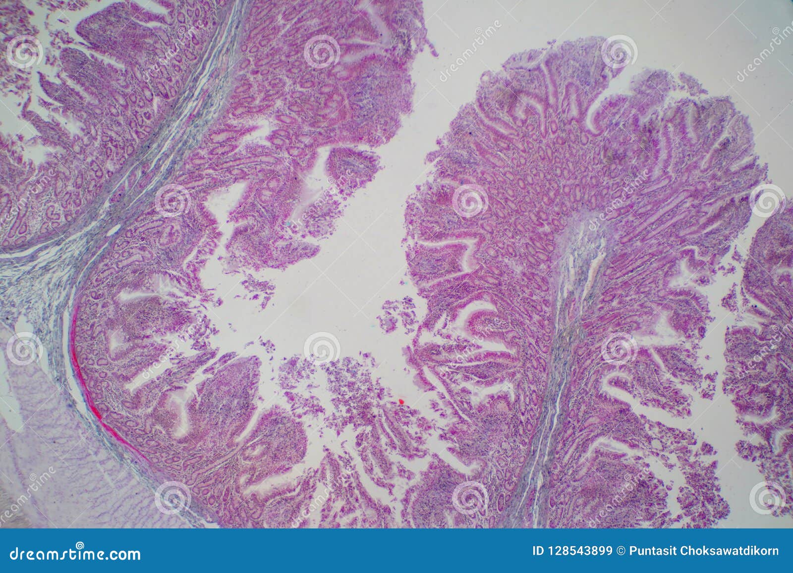 Human Large Intestine Tissue Under Microscope View. Stock Image - Image ...