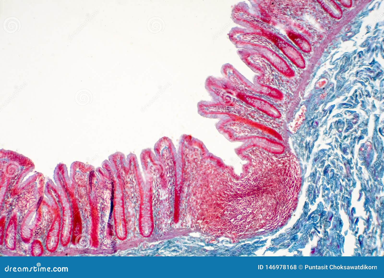Human Large Intestine Tissue Under Microscope View Stock Illustration ...