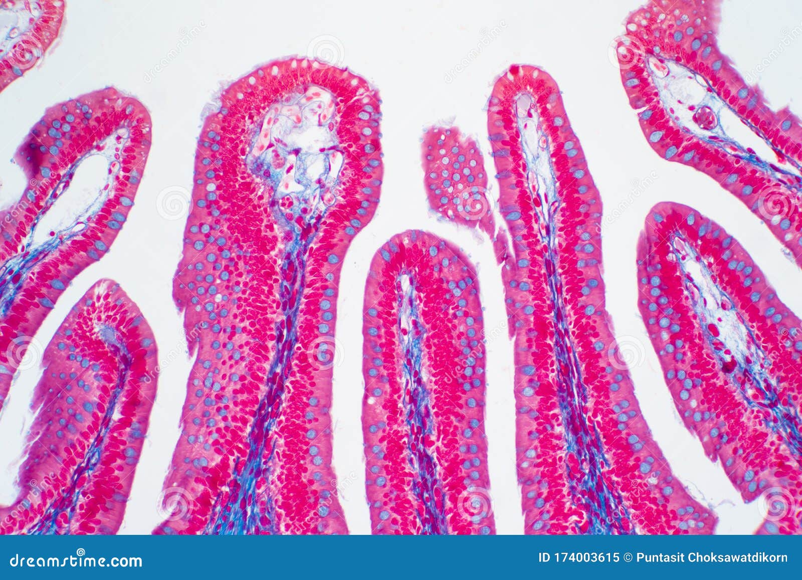 Human Large Intestine Tissue Under Microscope View Royalty-Free Stock ...