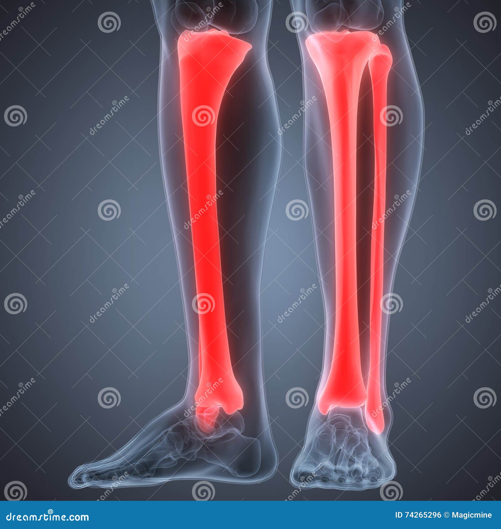 Humerus,tibia,femur,fibula,clavicle,sternum,scapula,mandible,axial ...