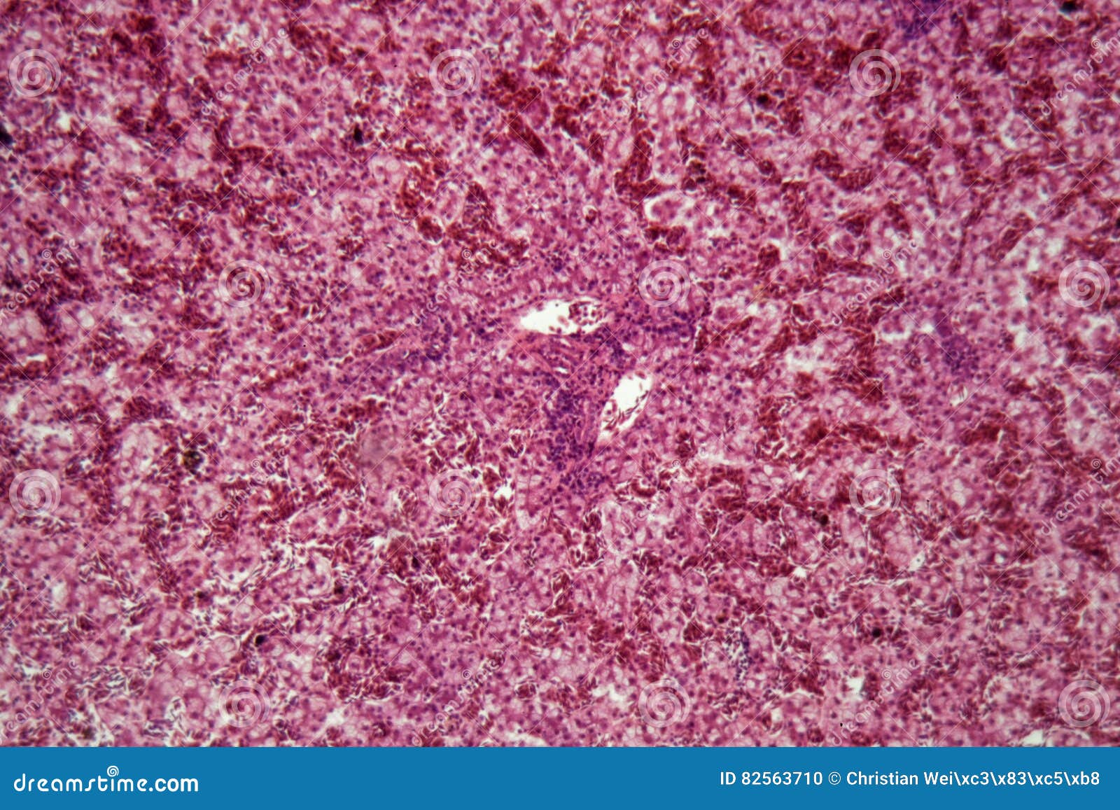 Human Liver Cells Under Microscope