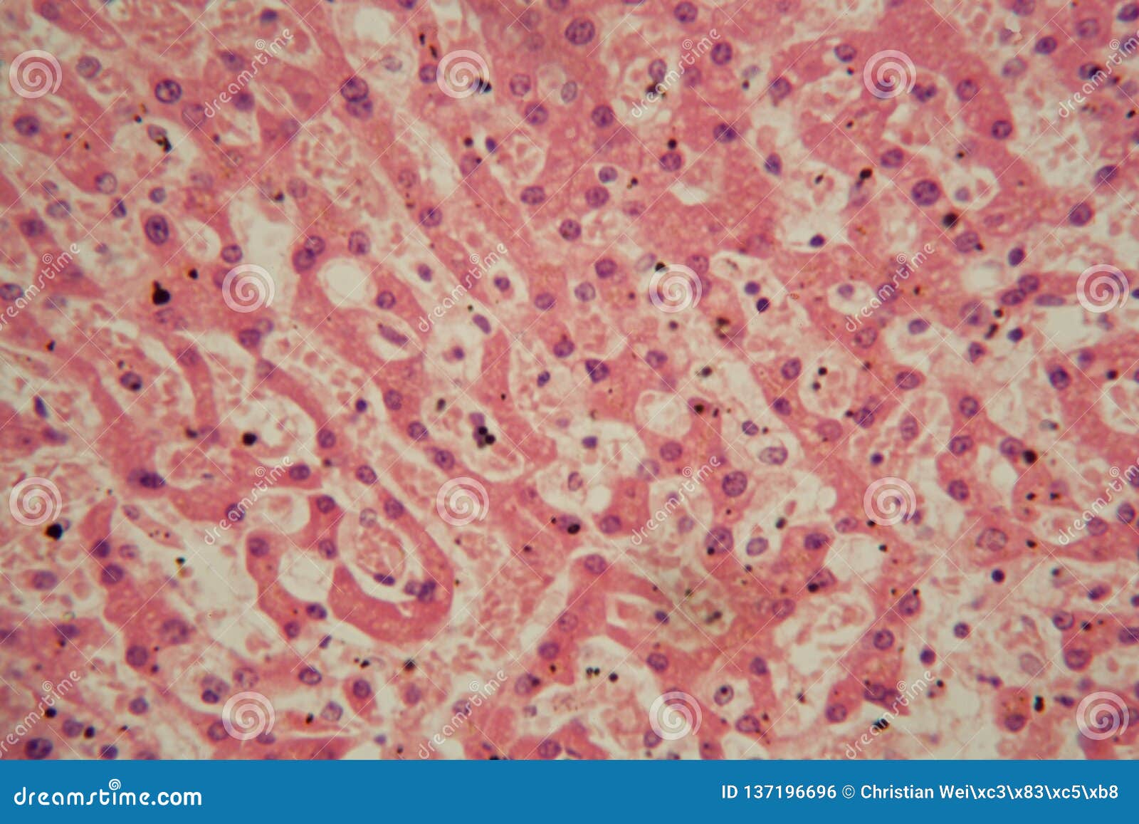 Human Liver Cells Under Microscope