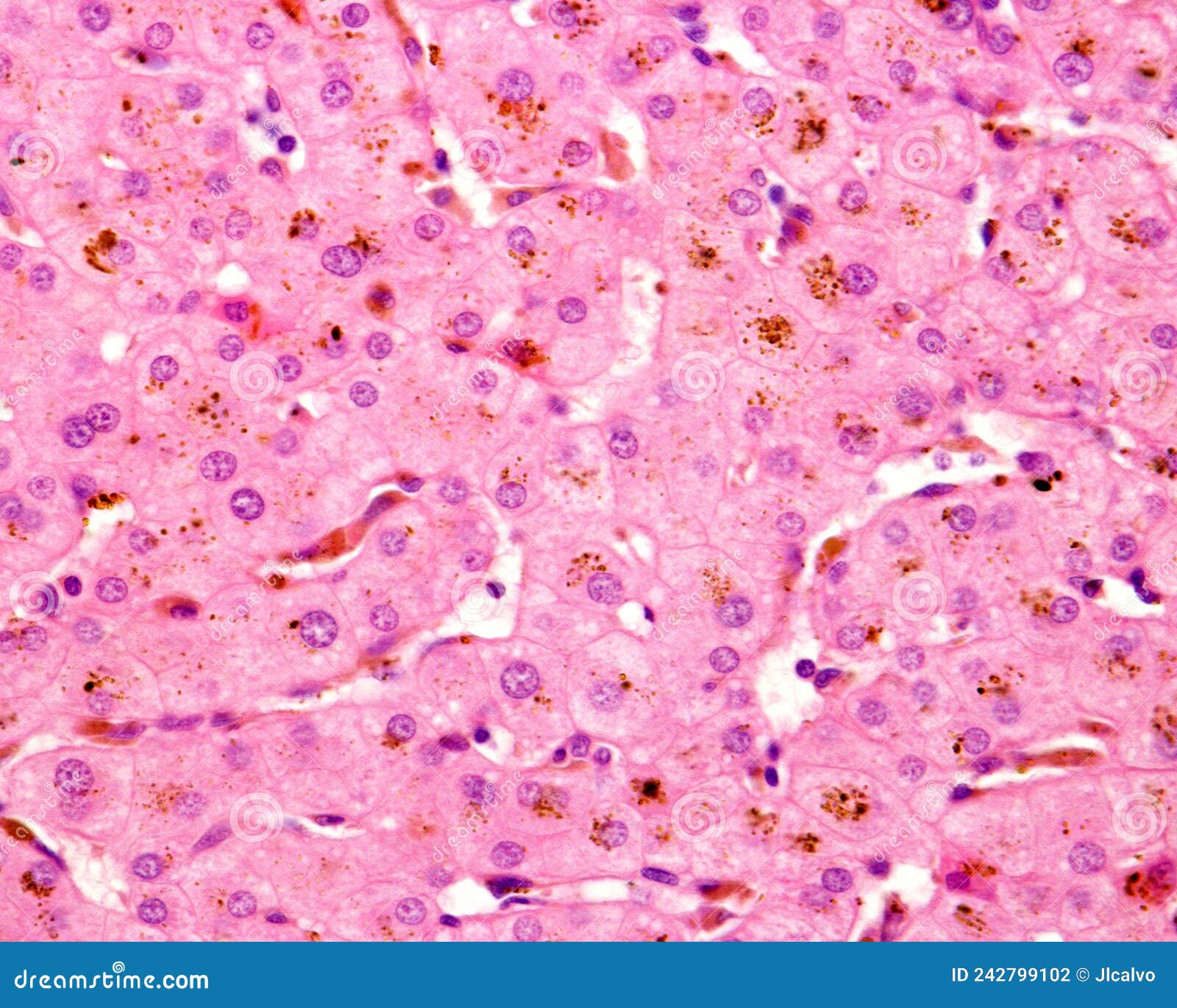 Human Hepatocyte. Nucleolus Stock Image | CartoonDealer.com #242799295