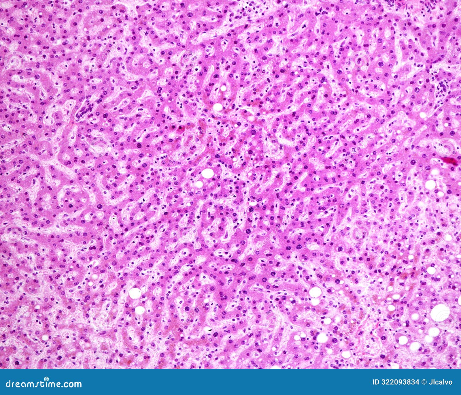 Human liver. Hepatic cords stock photo. Image of micrograph - 322093834