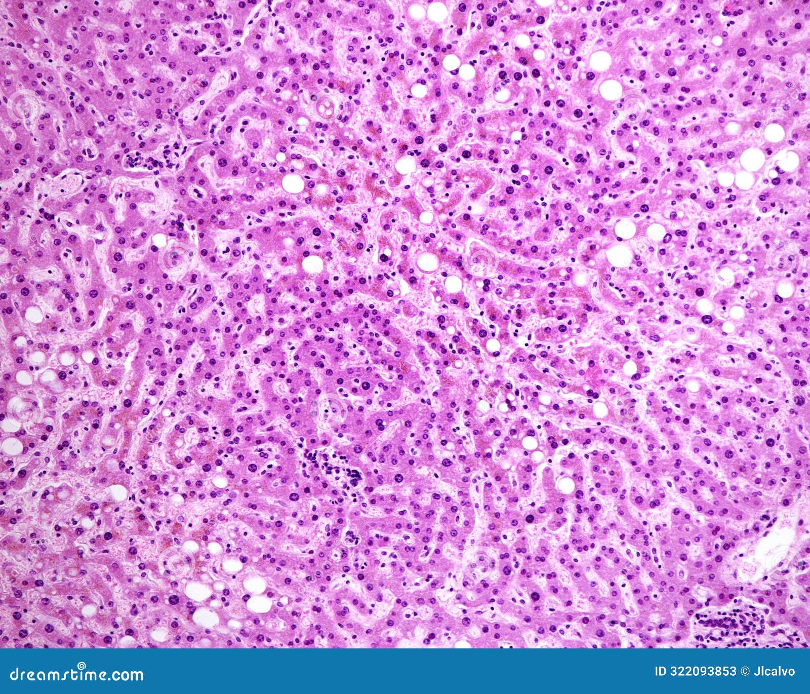 Human liver. Hepatic cords stock image. Image of eosin - 322093853