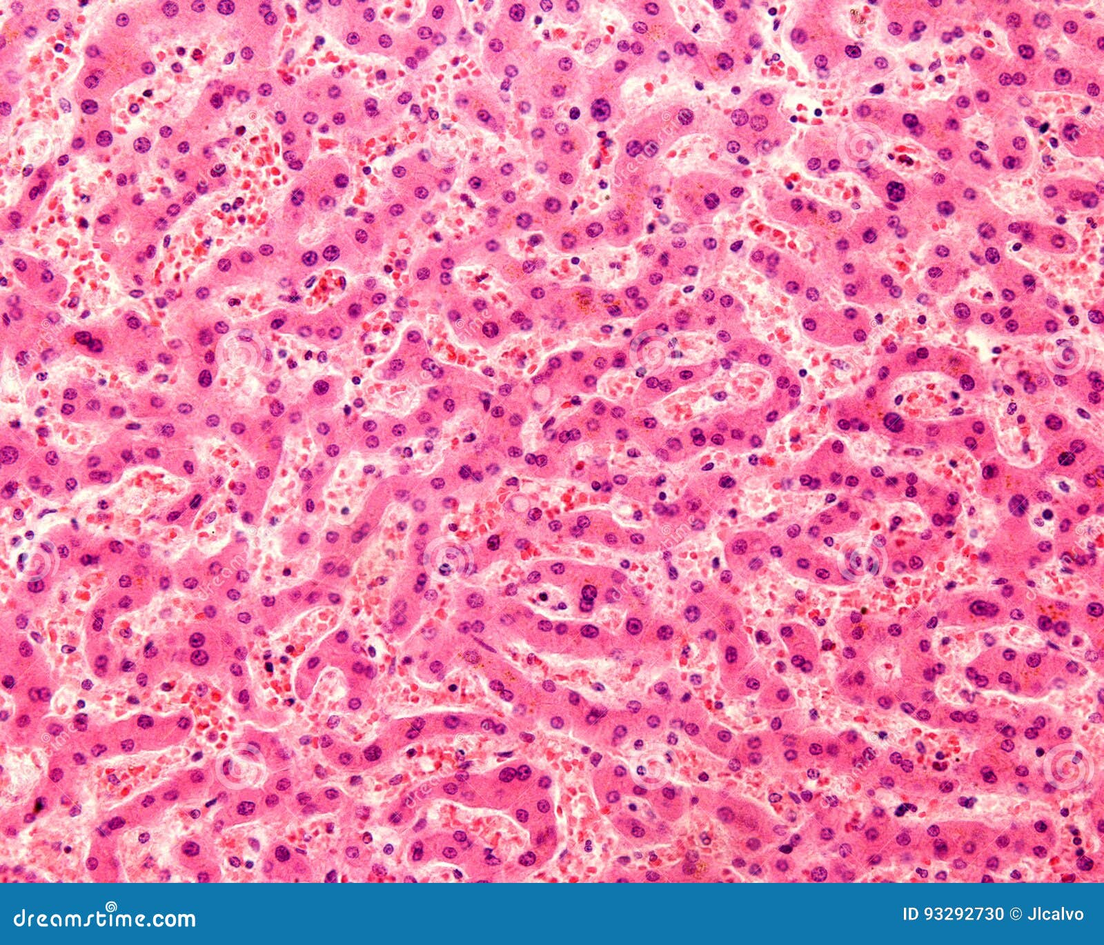 Hepatocyte Is Cell Of The Main Parenchymal Tissue Of The Liver Under ...