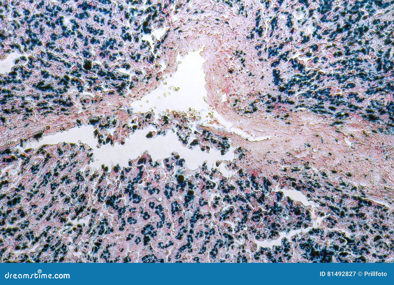 Human liver micrography stock image. Image of close, magnification ...