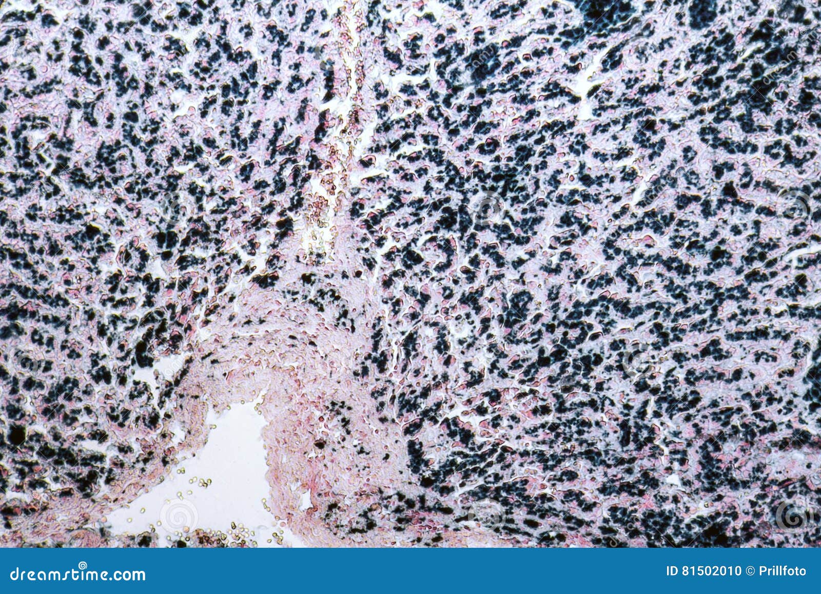 Human liver micrography stock photo. Image of translucent - 81502010