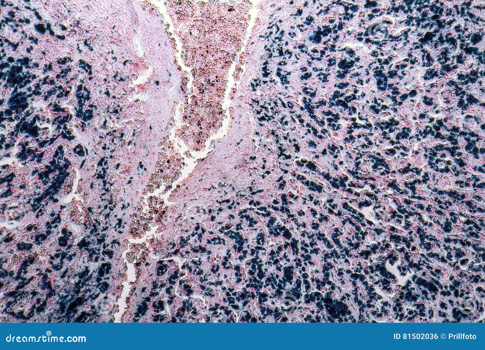 Human liver micrography stock photo. Image of cell, gland - 81502036