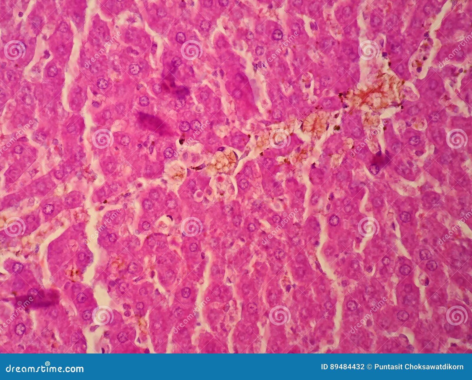 Human liver tissue stock photo. Image of disease, biology - 89484432