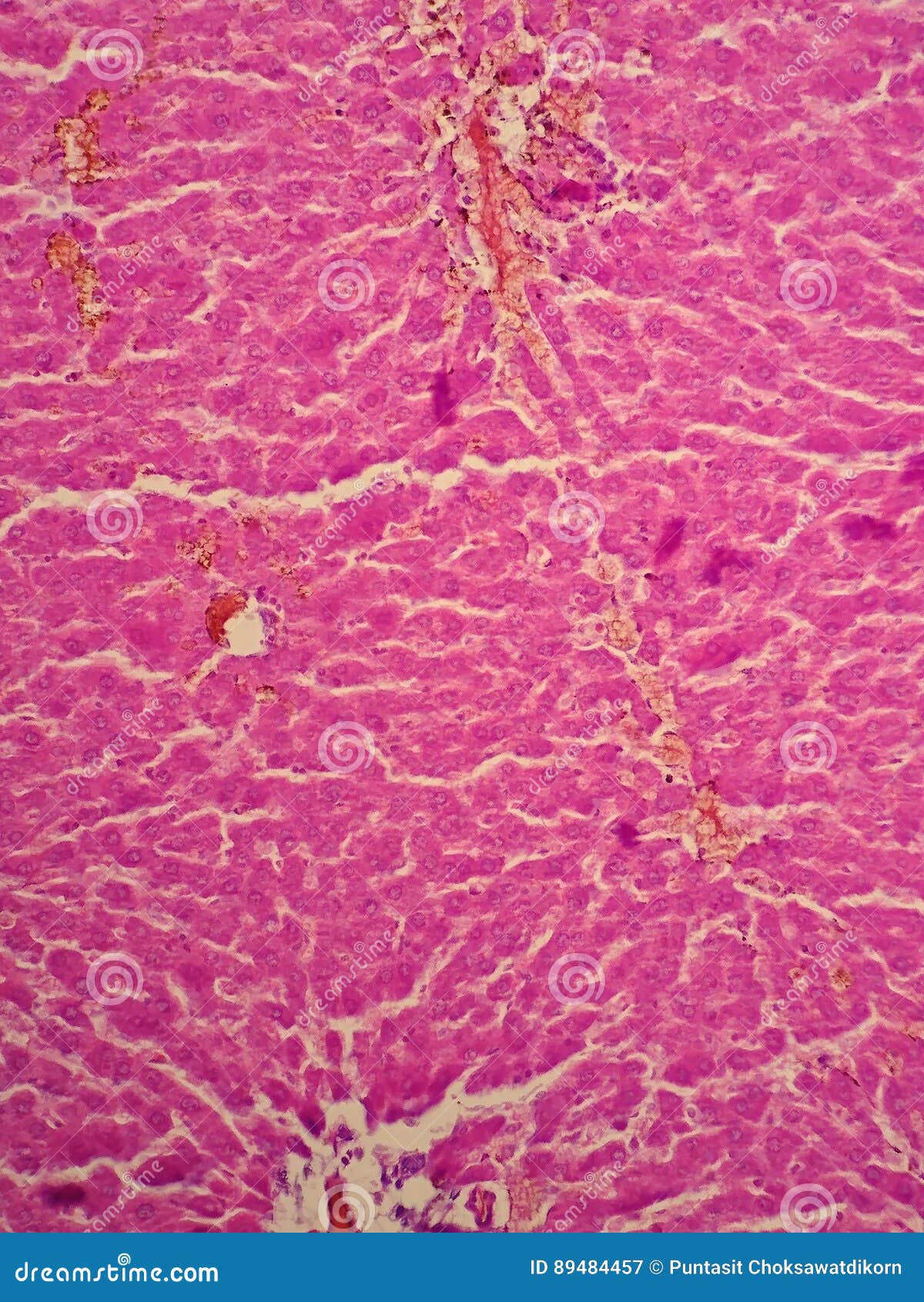 Human liver tissue stock image. Image of histology, death - 89484457