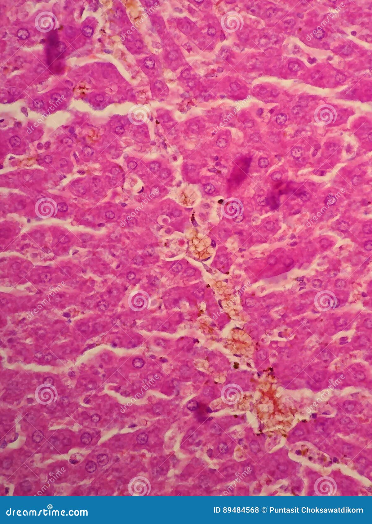 Human liver tissue stock photo. Image of healthcare, microbiology ...