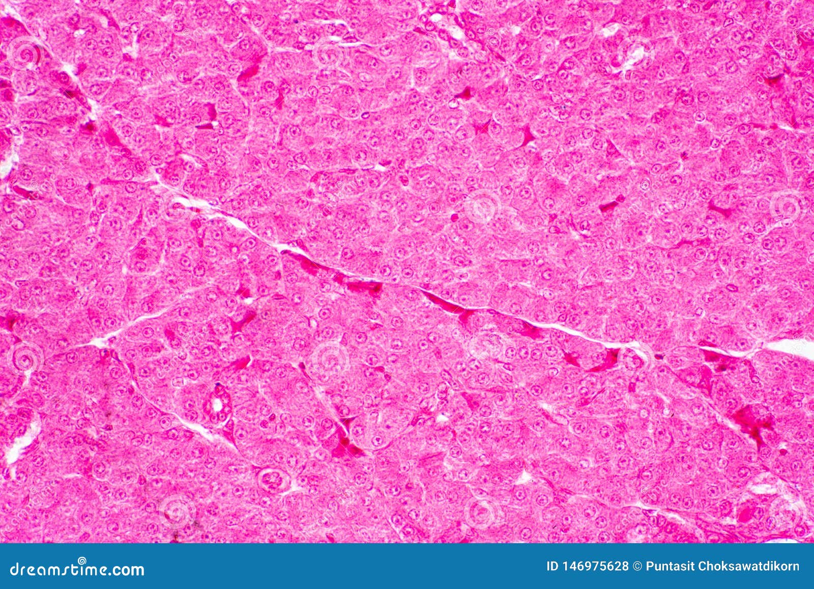 Human Liver Tissue Under Microscope View for Education Histology Stock ...