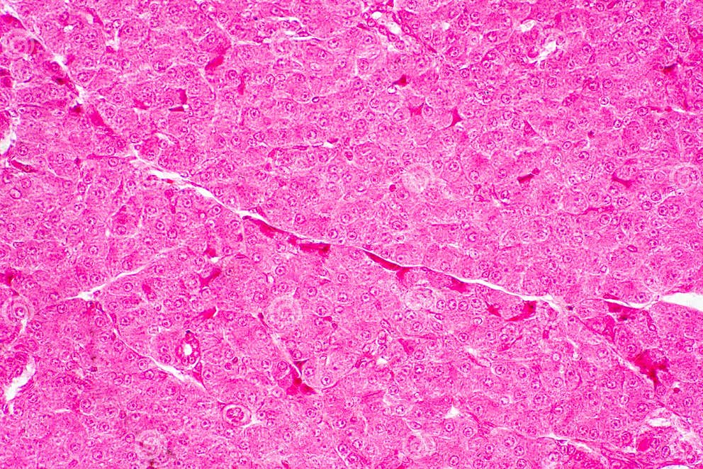 Human Liver Tissue Under Microscope View for Education Histology Stock ...
