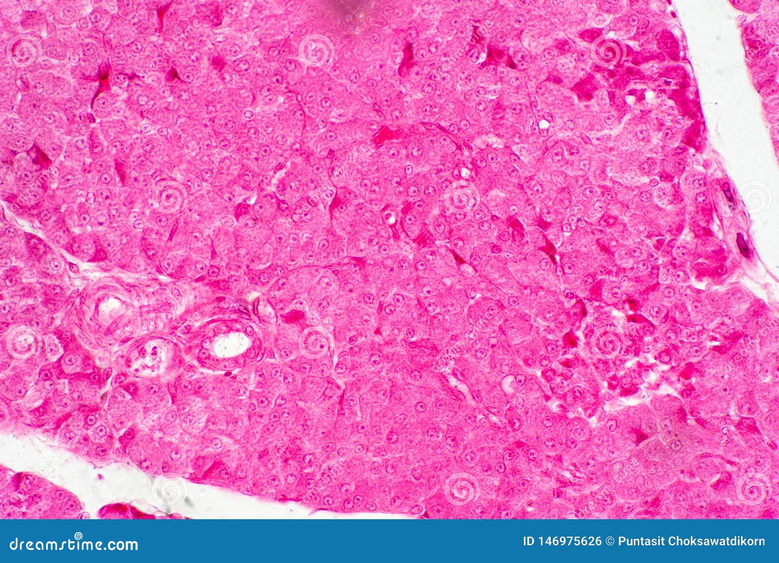 Human Liver Tissue Under Microscope View for Education Histology Stock ...