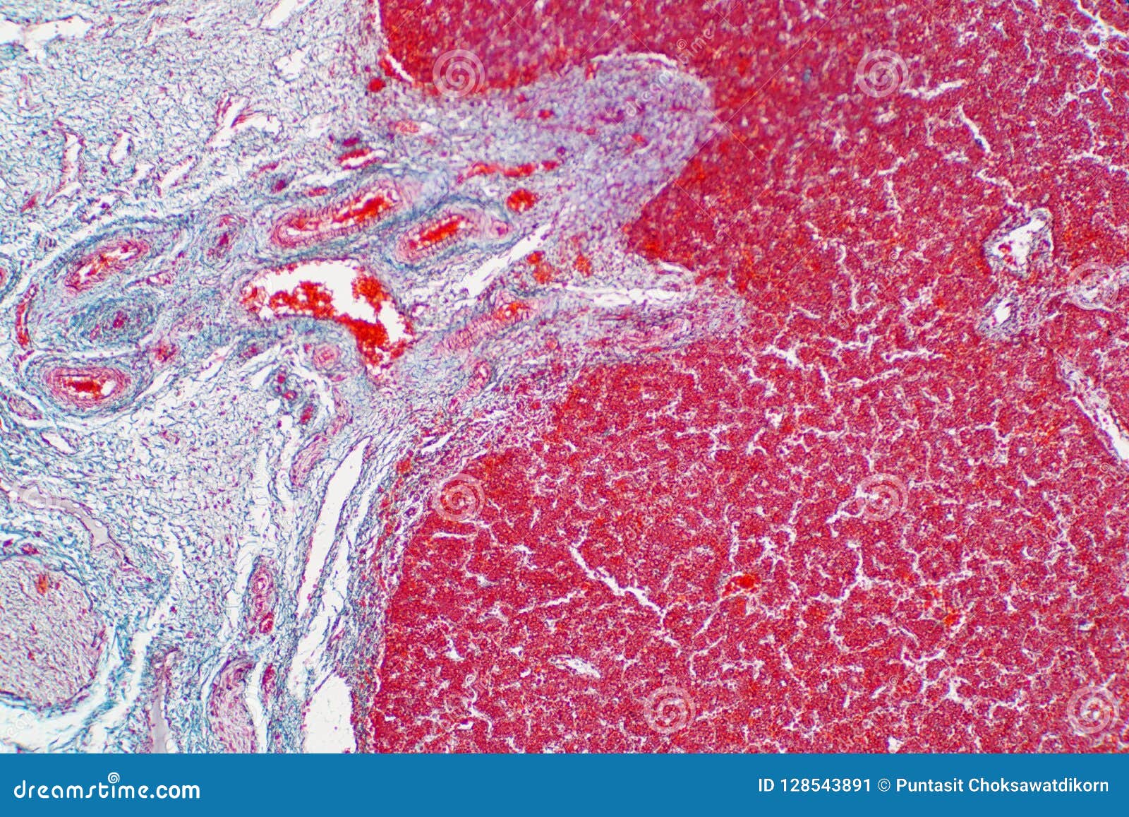 Human Liver Tissue Under The Microscope View. Royalty-Free Stock ...