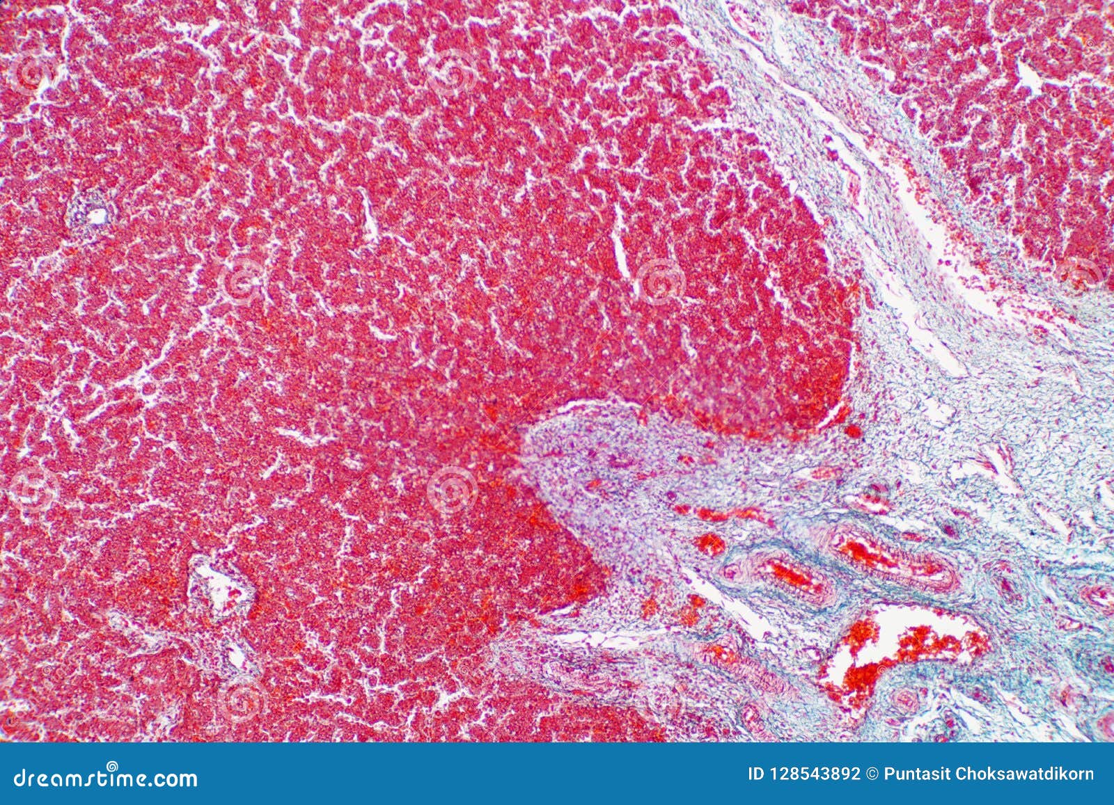 Human Liver Tissue Under the Microscope View. Stock Photo - Image of ...