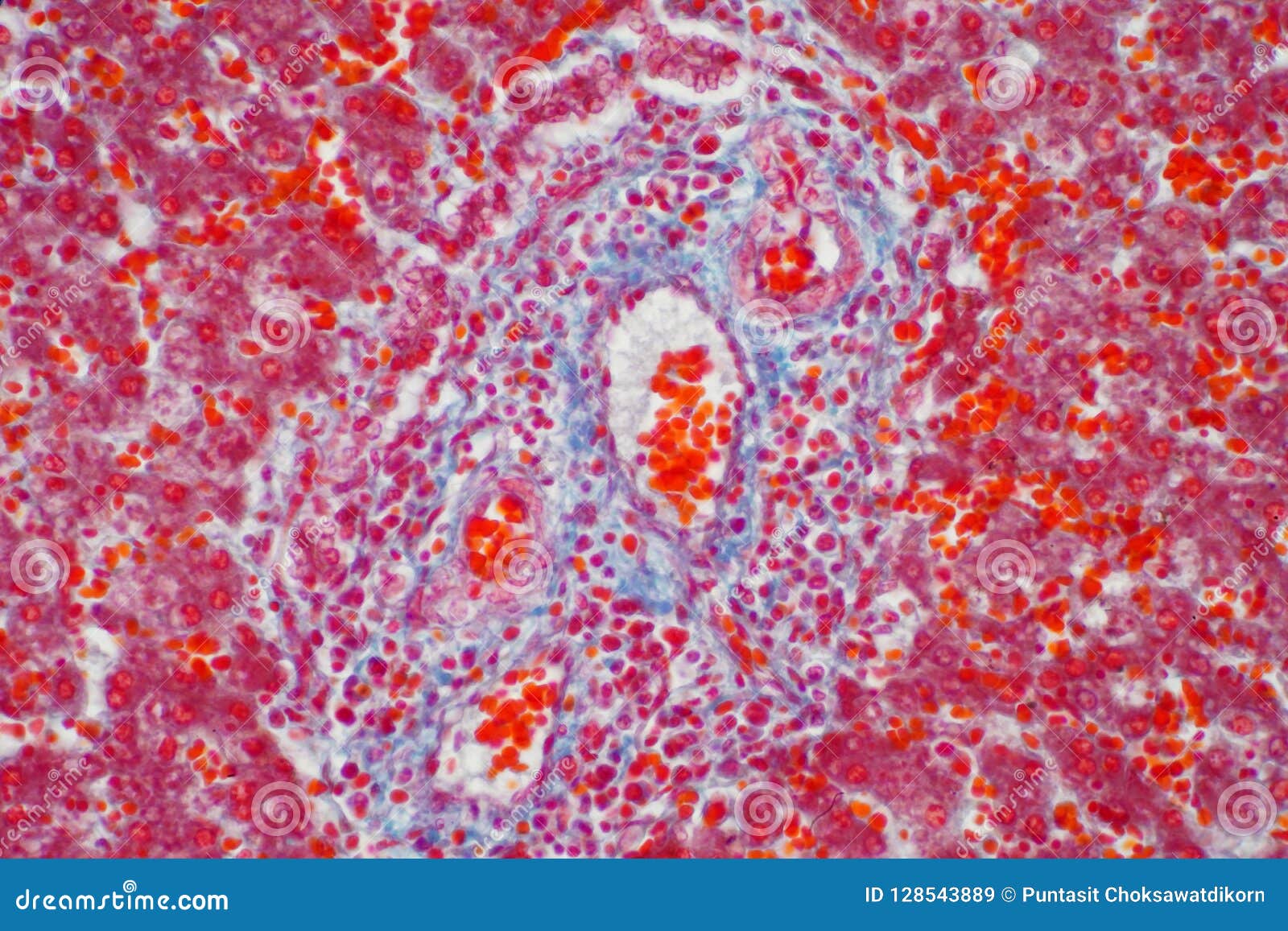 Human Liver Tissue Under the Microscope View. Stock Image - Image of ...