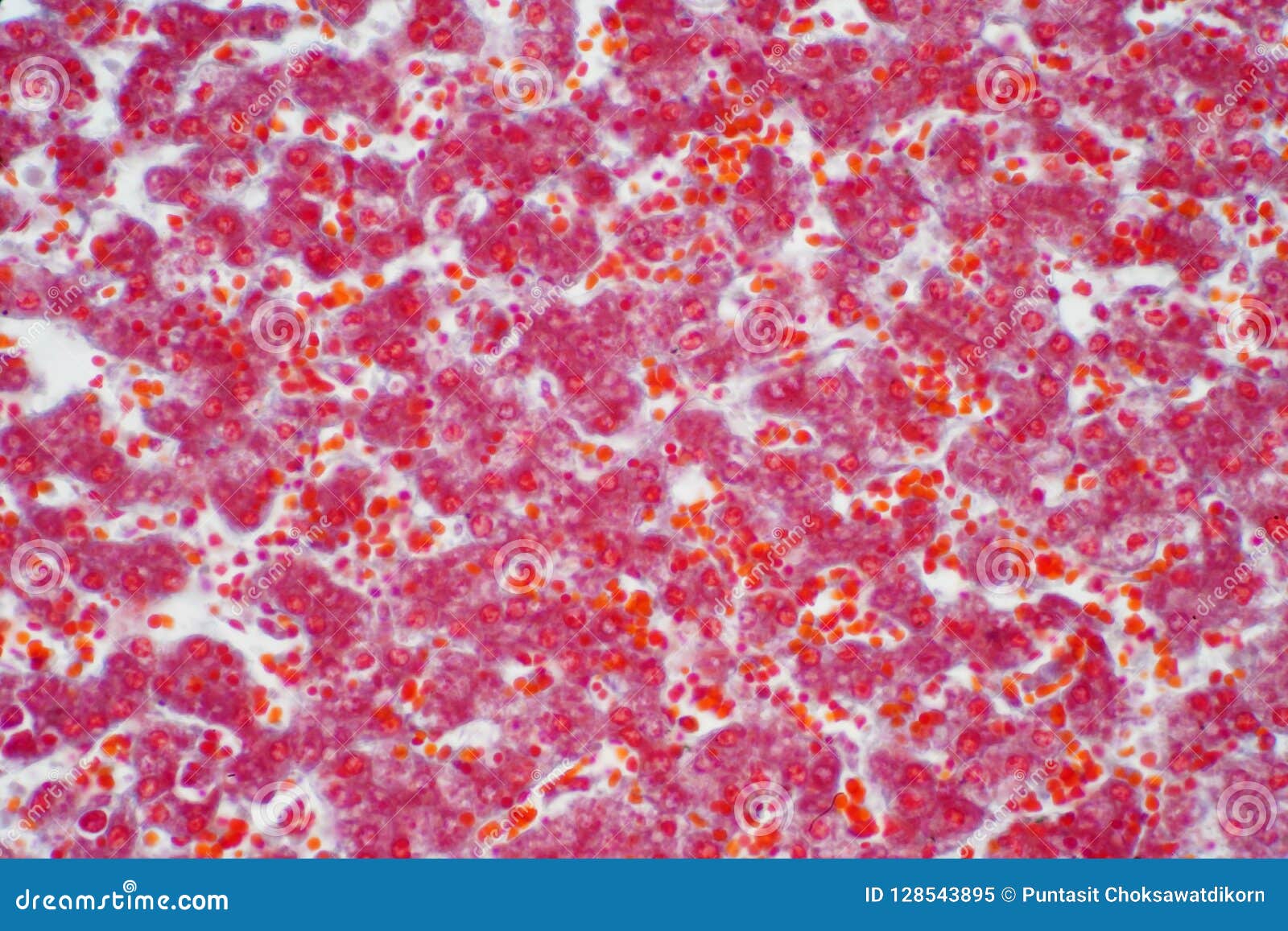 Human Liver Tissue Under the Microscope View. Stock Image - Image of ...