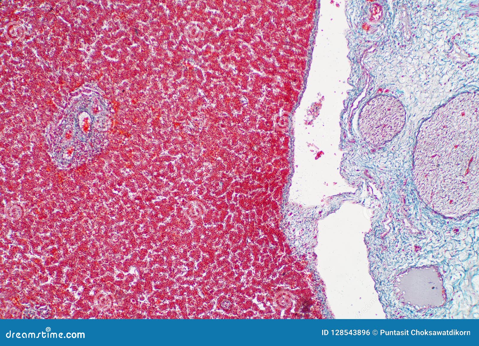 Human Liver Tissue Under the Microscope View. Stock Photo - Image of ...