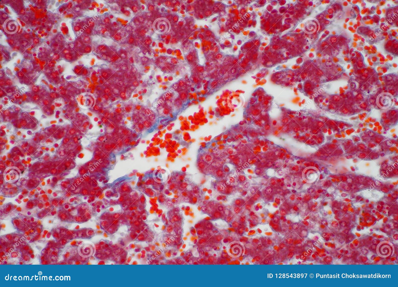 Human Liver Tissue Under the Microscope View. Stock Image - Image of ...