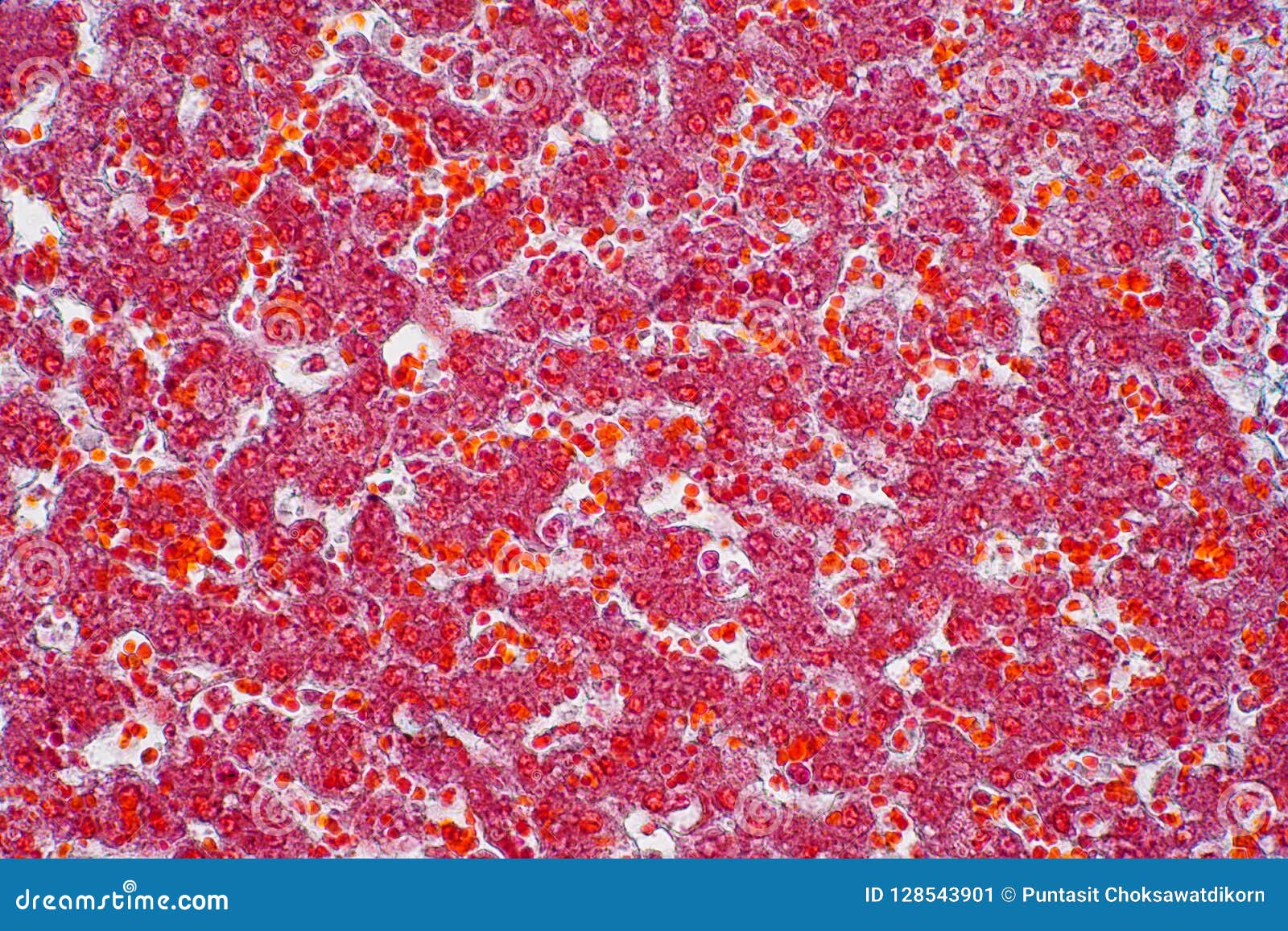 Human Liver Tissue Under The Microscope View. Royalty-Free Stock Photo ...
