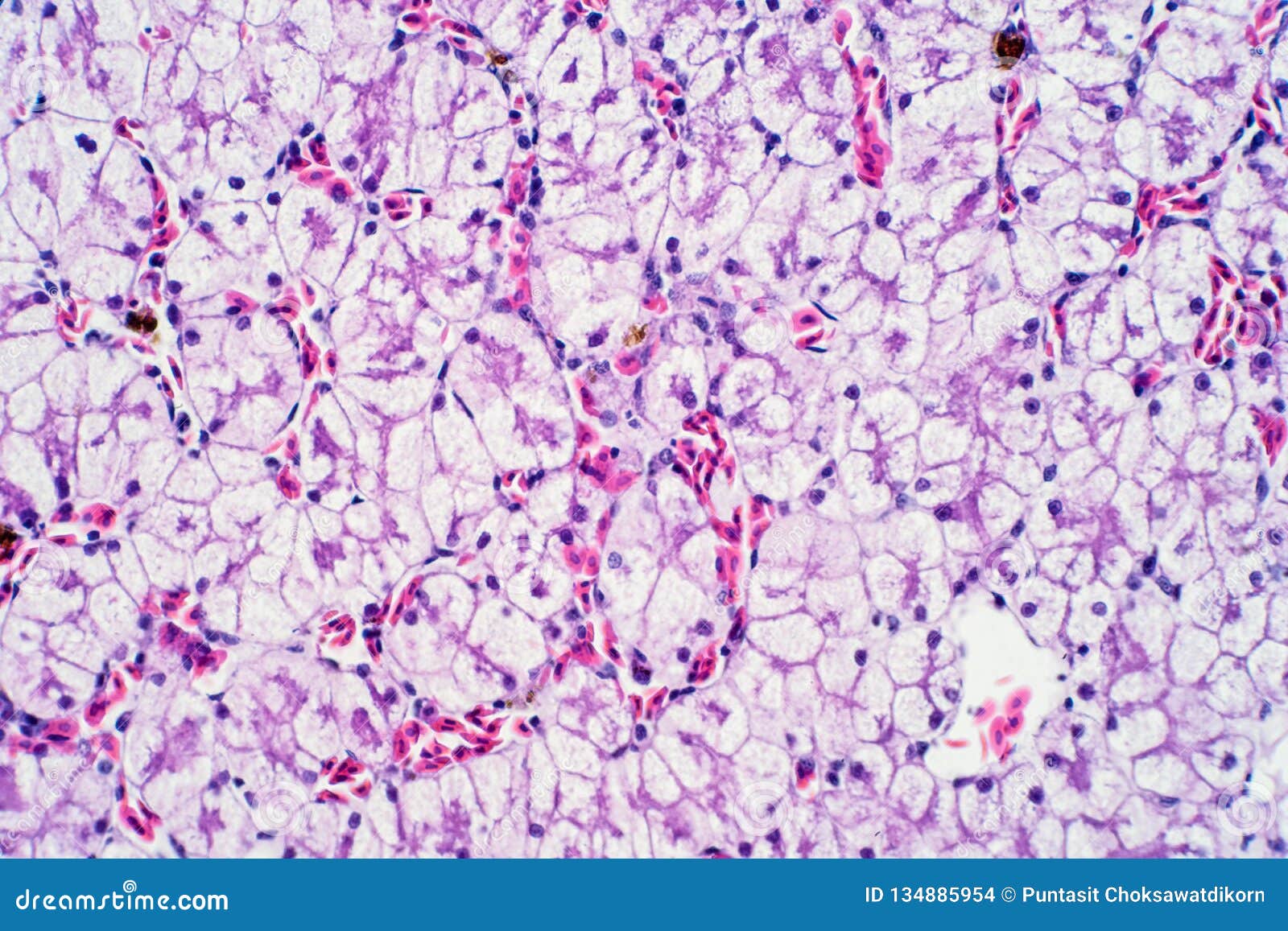 Human Liver Tissue Under the Microscope View Stock Photo - Image of ...