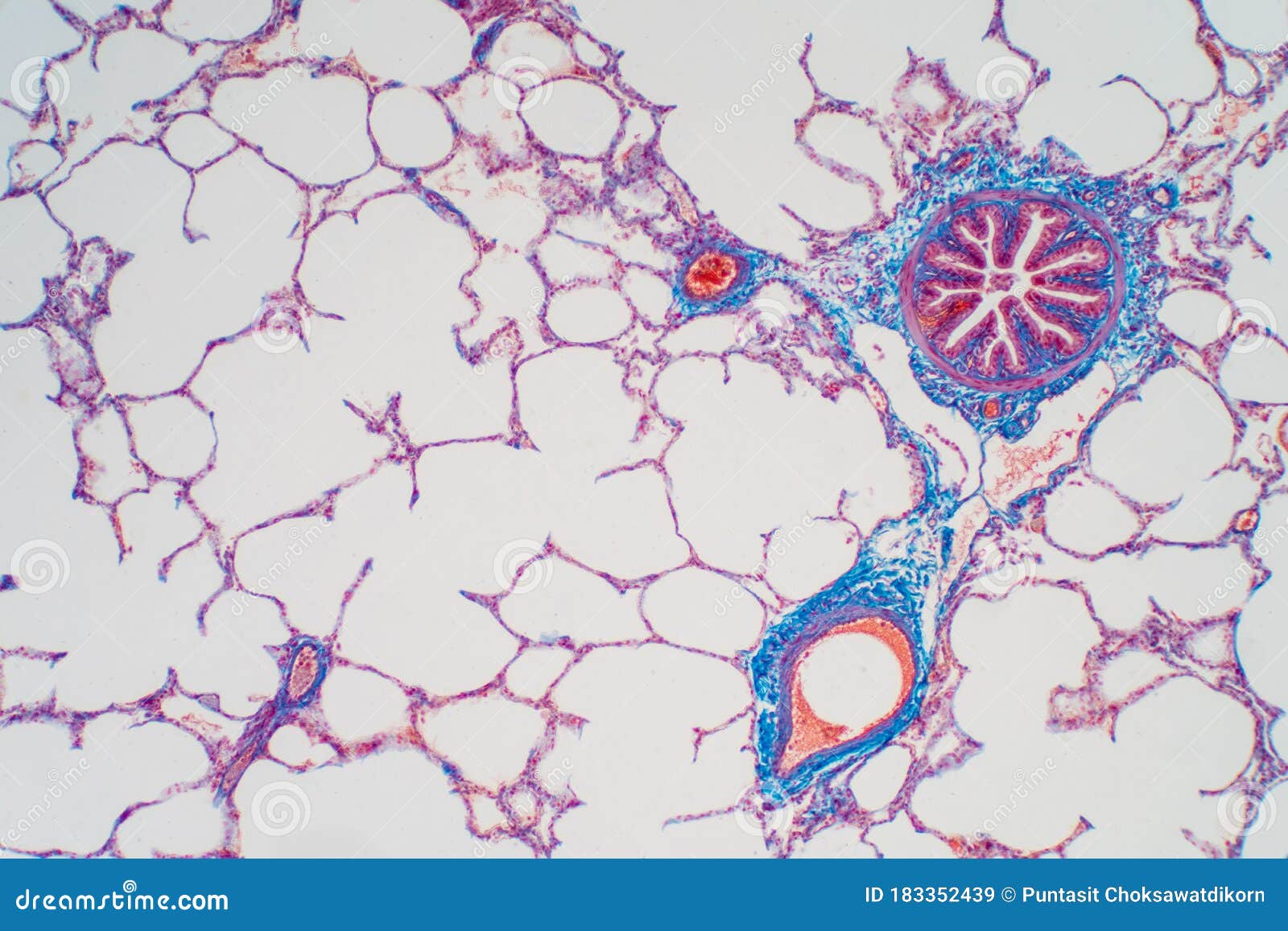 Human Lung Tissue Under Microscope, the Lungs is Organs of the ...