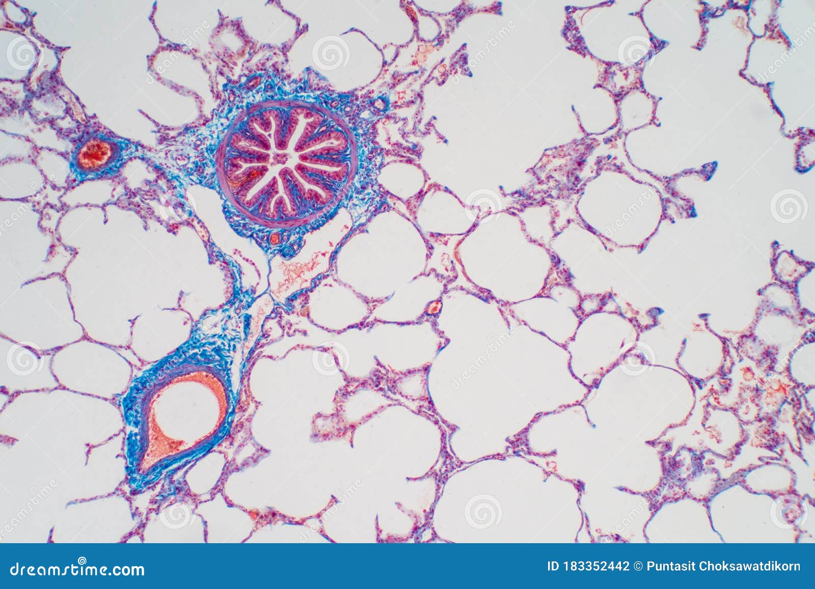 Human Lung Tissue Under Microscope, the Lungs is Organs of the ...
