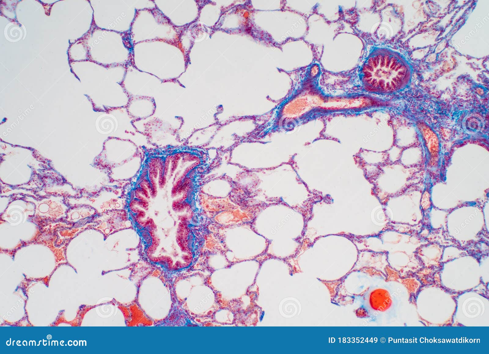 Human Lung Tissue Under Microscope, the Lungs is Organs of the ...