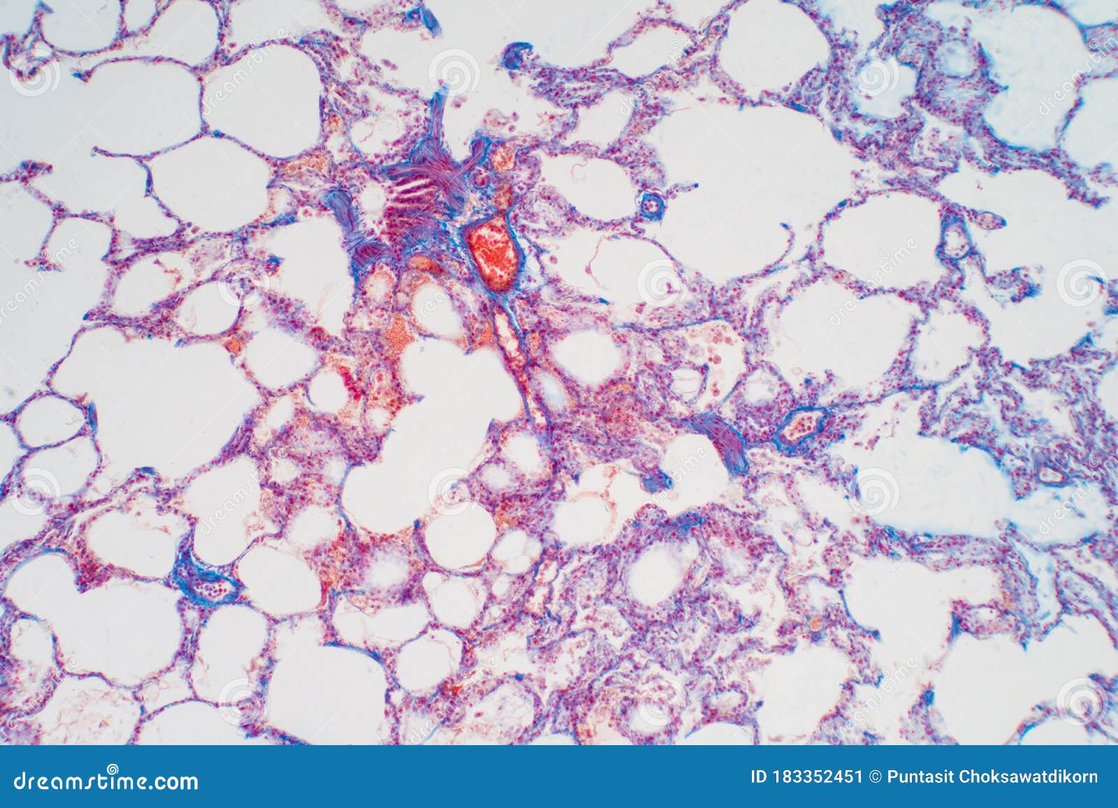 Respiratory System Tissues
