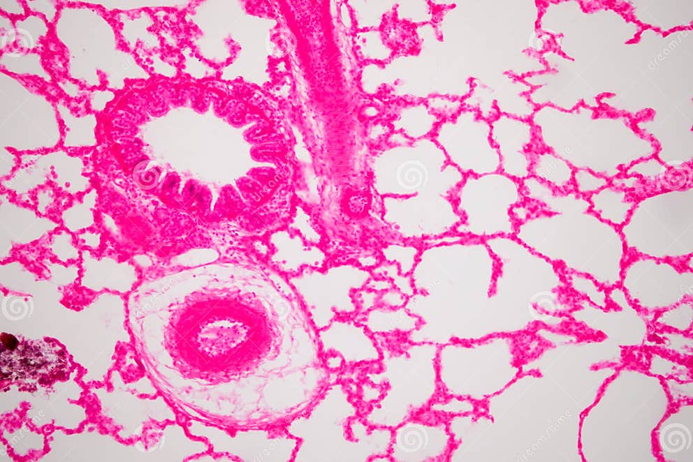Human Lung Tissue Under Microscope View. Stock Image - Image of effects ...