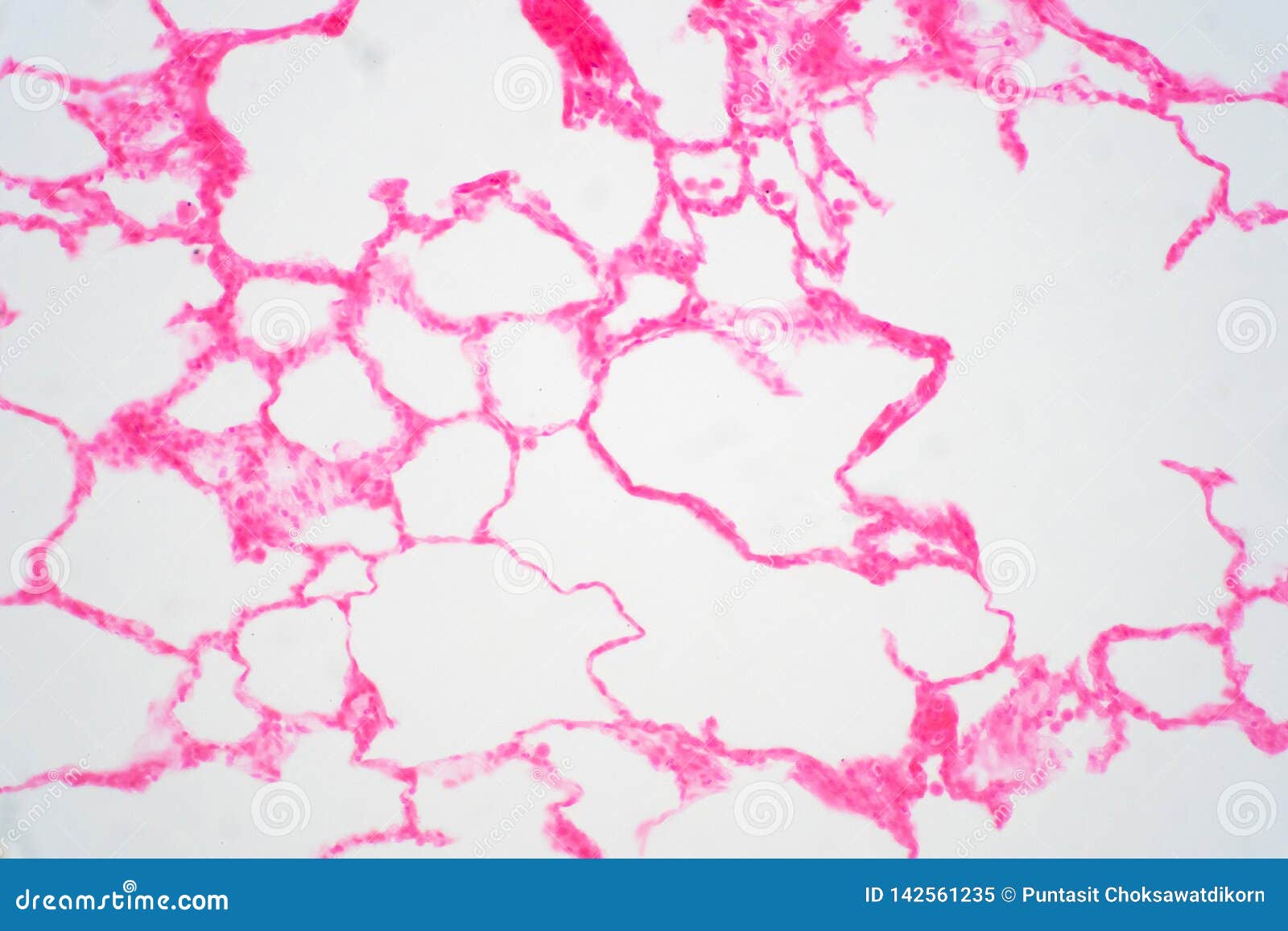 Human Lung Tissue Under Microscope View Stock Image - Image of breathe ...