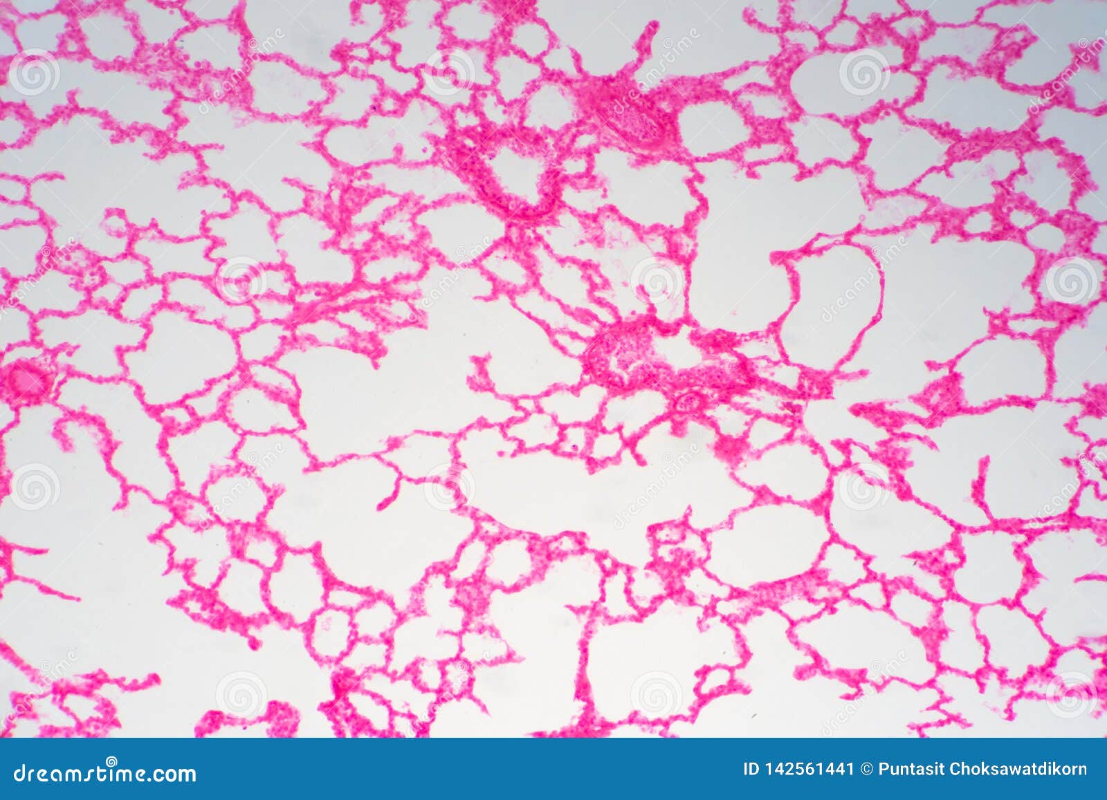 Human Lung Tissue Under Microscope View Stock Image - Image of biology ...