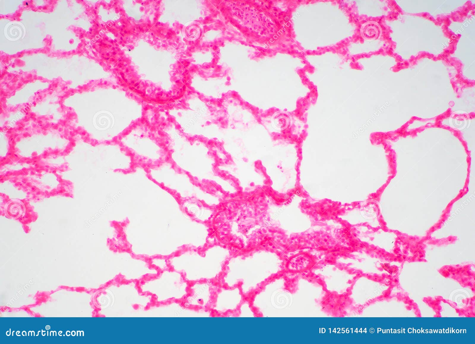 Human Lung Tissue Under Microscope View Stock Photo - Image of organs ...