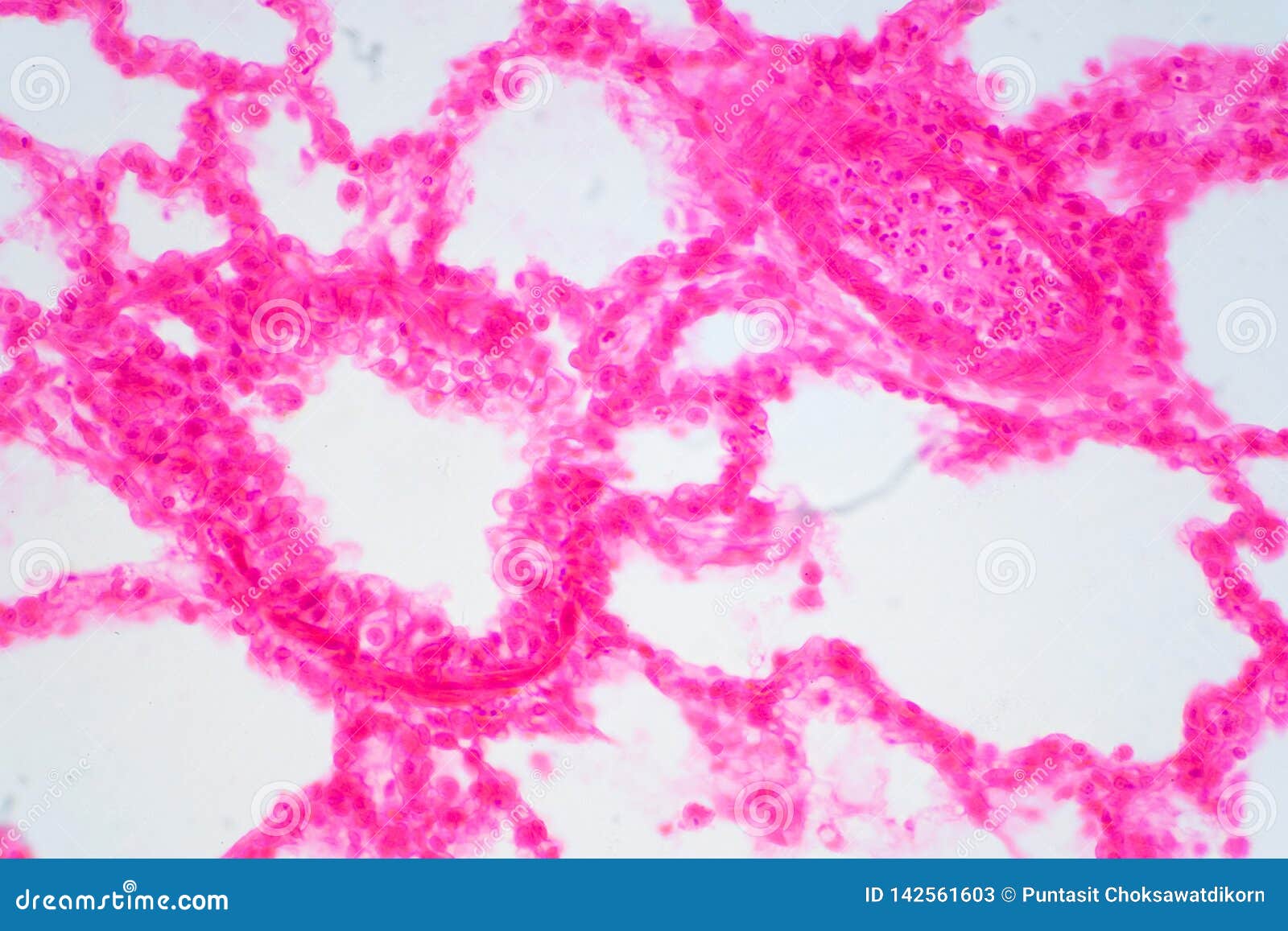 Human Lung Tissue Under Microscope View Stock Image - Image of inhale ...