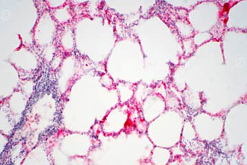 Human Lung Tissue Under Microscope View Stock Photo - Image of health ...