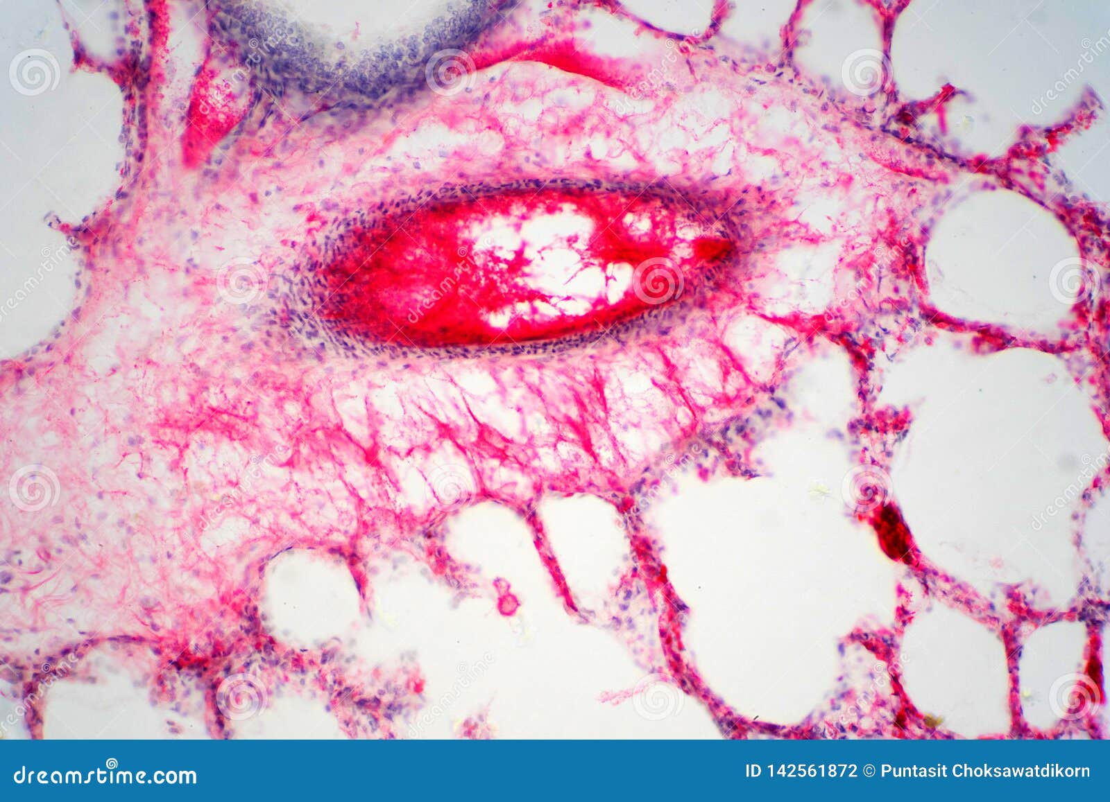Human Lung Tissue Under Microscope View Stock Photo - Image of biology ...