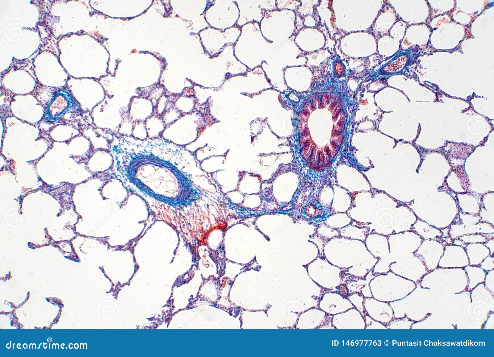 Human Lung Tissue Under Microscope View Stock Image - Image of ...