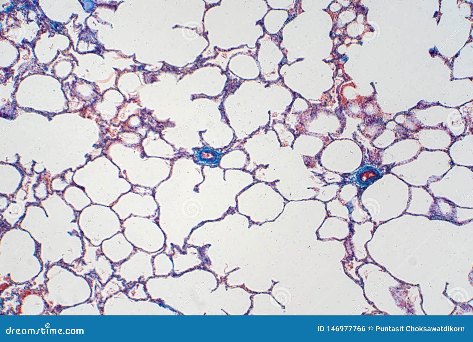 Human Lung Tissue Under Microscope View Stock Photo - Image of health ...