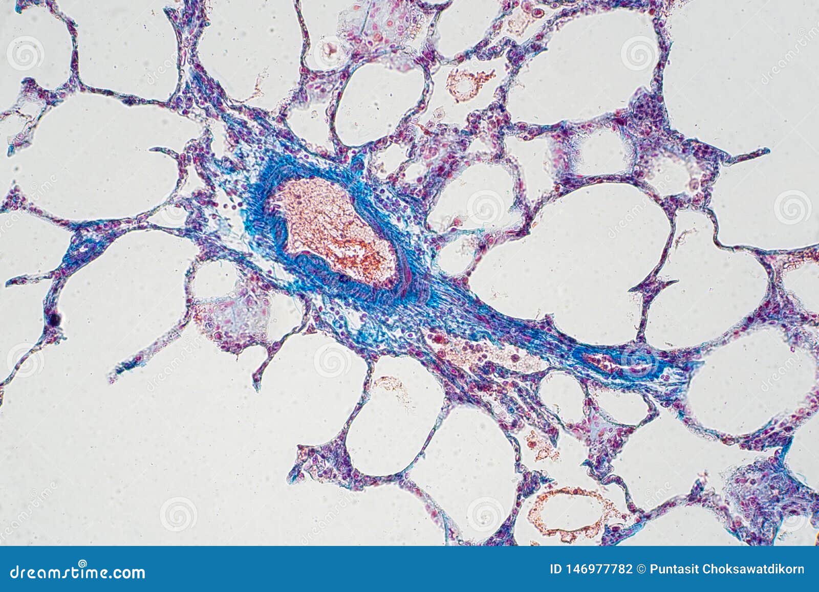 Human Lung Tissue Under Microscope View Stock Photo - Image of cell ...