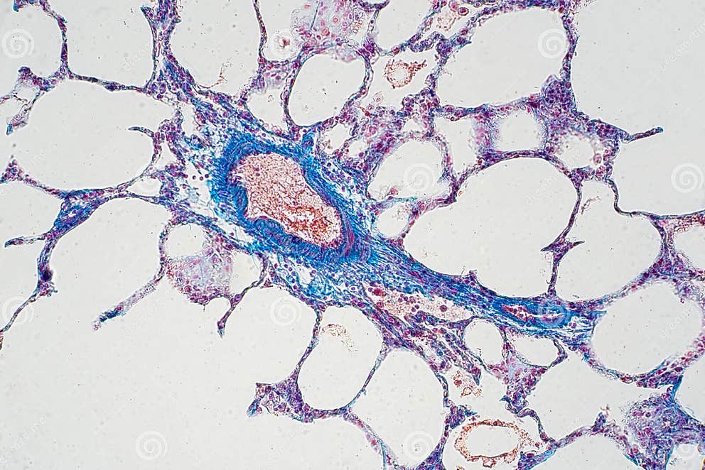 Human Lung Tissue Under Microscope View Stock Photo - Image of cell ...