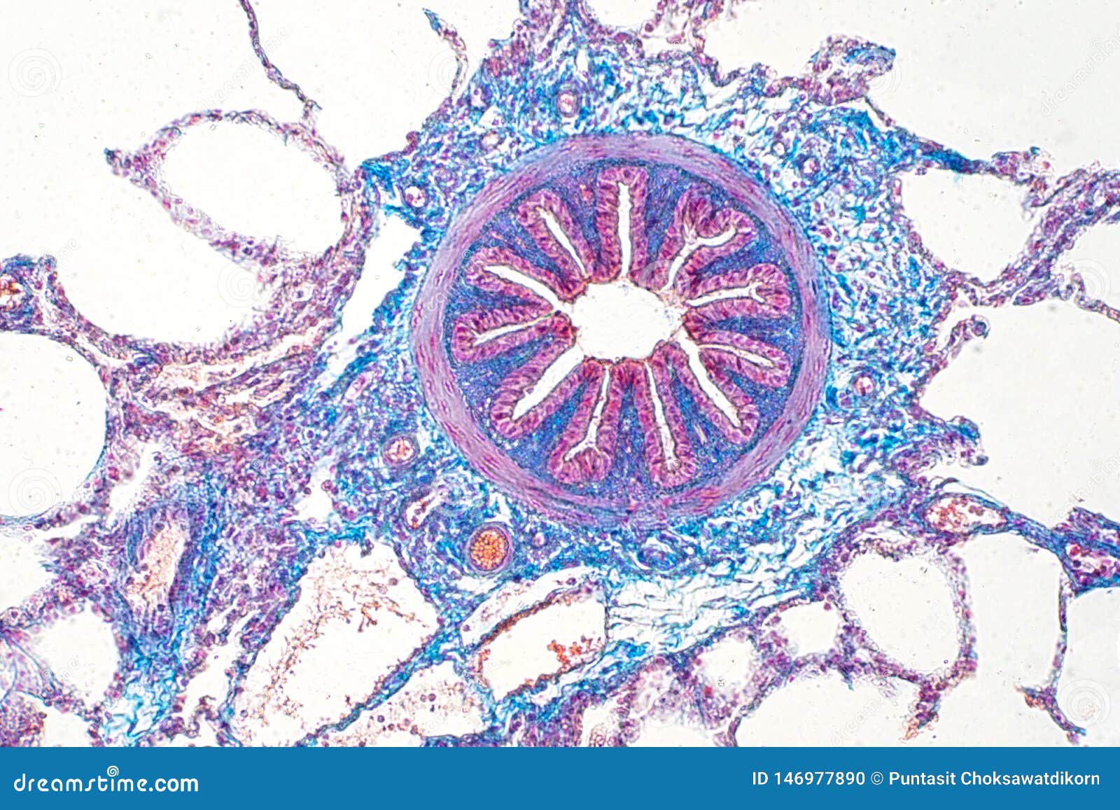 Human Lung Tissue Under Microscope View Stock Photo - Image of medical ...