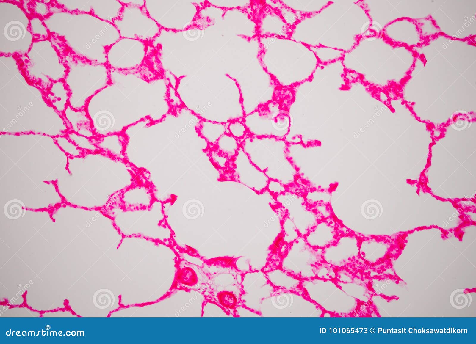Human Lung Tissue Under Microscope View. Stock Image - Image of bronchi ...